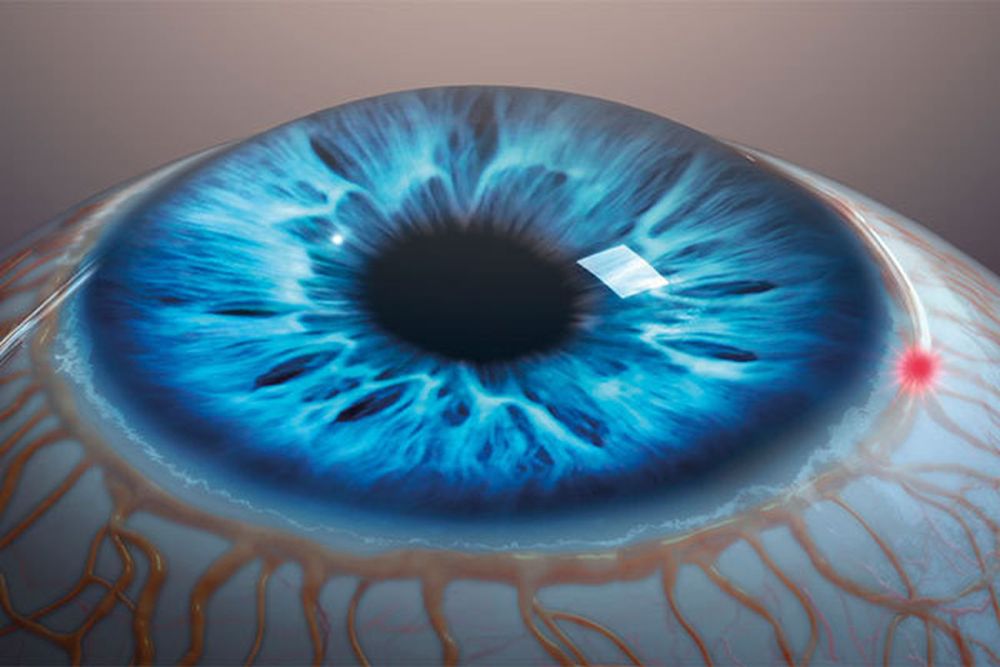 iTrack™ - Nova Eye Medical US