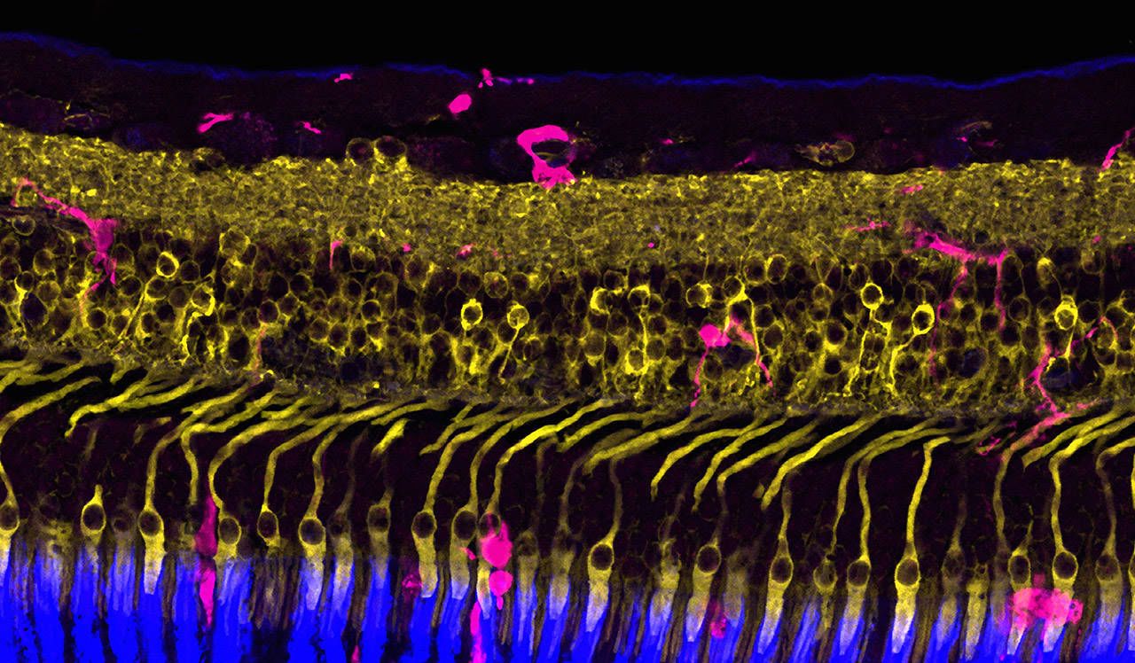 AlphaRET - Nova Eye Medical